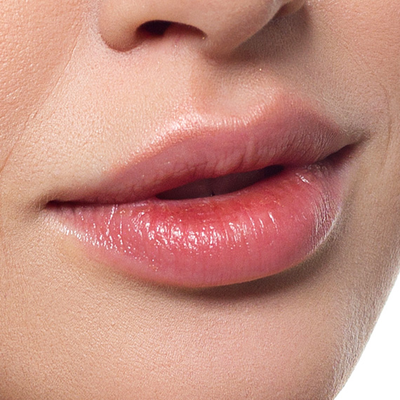 Russian Lips in North York by Elysium Beauty Clinic